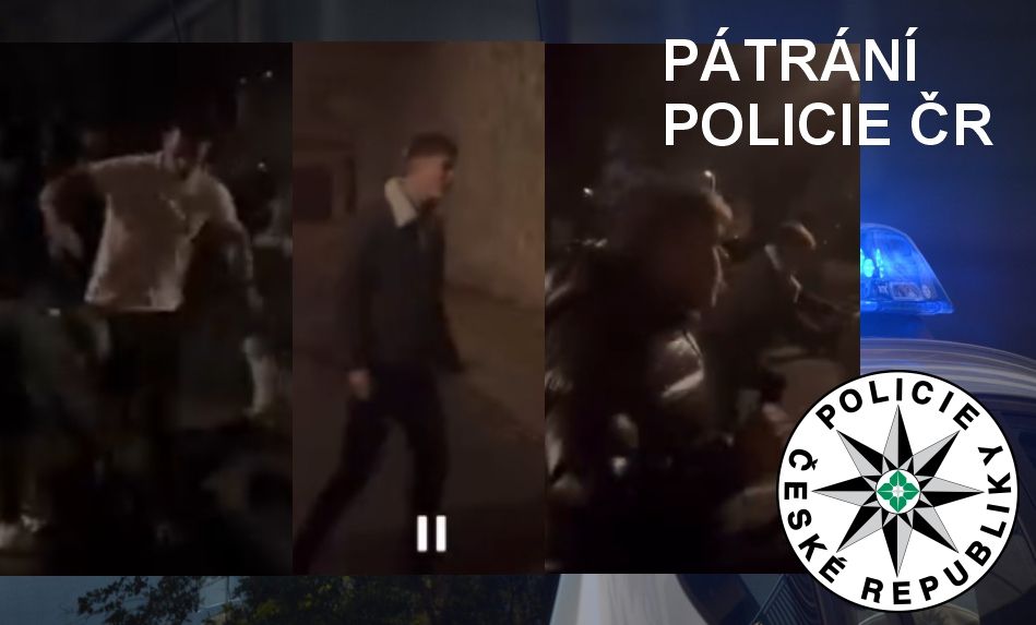 TEPLICE: Mladík při bitce utrpěl zlomeniny v obličeji. Nepoznáte osoby ...